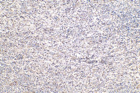Ihceasy Alix Ready To Use Ihc Kit Khc0873 Proteintech 武汉三鹰生物技术有限公司