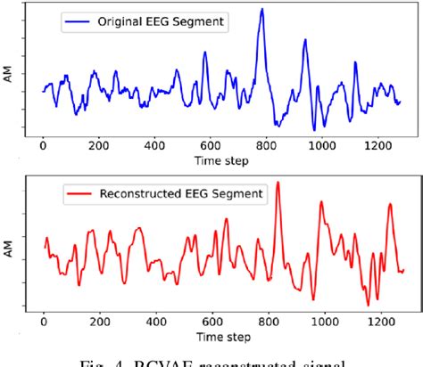 Figure 4 From Epileptic Seizures Prediction Based On Unsupervised