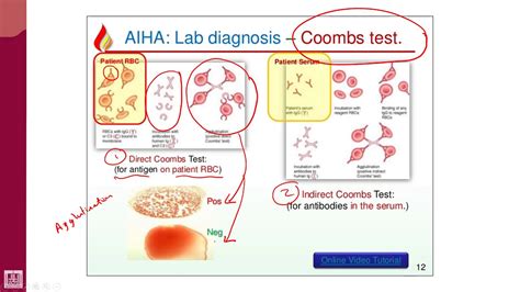 What Is The Coombs Test At Audrey Cunningham Blog