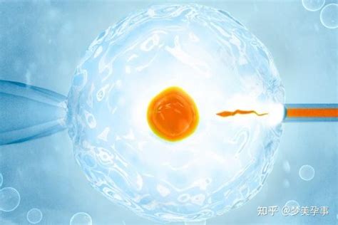 哪些不孕不育人群需要做试管婴儿呢 知乎