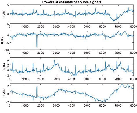Figure 6 From Design And Realization Of Non Invasive Fetal Ecg