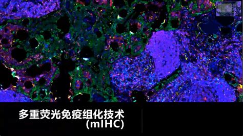 多重荧光免疫组化技术讲座 [爱必信absin]