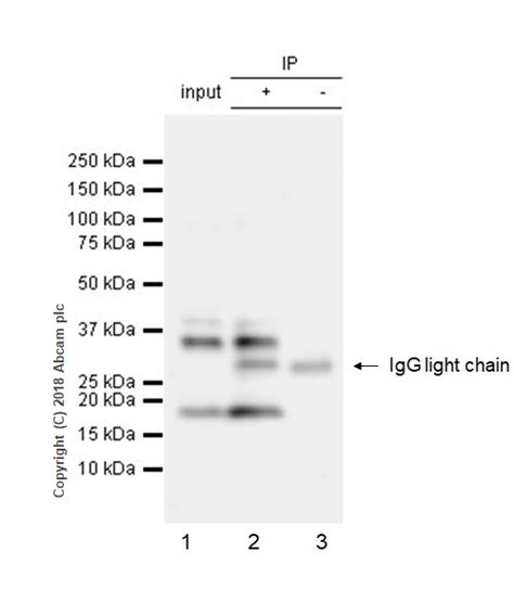 Anti Cebp Beta Antibody E299 C Terminal Ab32358 Abcam