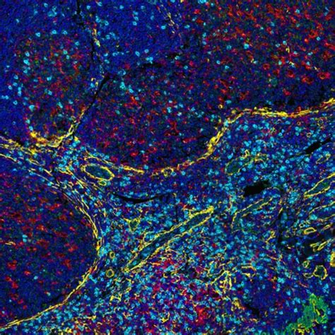 Stream Mitochondria The Immune System And Cancer Discovering New