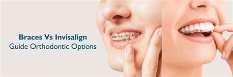 Braces Vs Invisalign Which Is Right For You