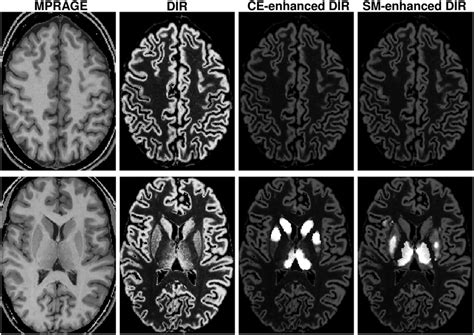 Representative Data Of Two Different Slices Rows For A Healthy Download Scientific Diagram