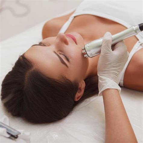 Radio Frequency Micro Needling Facial Essence Med Spa And Wellness Center In Edgebrook Chicago Il