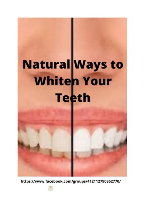 Ppt Natural Ways To Whiten Your Teeth Powerpoint Presentation Free