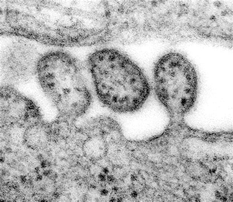 5 Lassa Hemorrhagic Fever Lassa Virus Free Images
