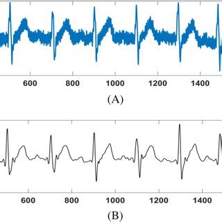 Visual Comparison Of The Noisy Signal And The Denoised Signal Recorded Download Scientific