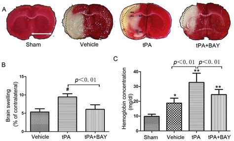 A2b Receptor Agonist Inhibits Tpa Induced Brain Swelling And