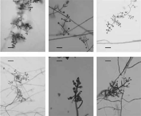 The Typical Morphological Structures Of Trichoderma Genus Conidiophore