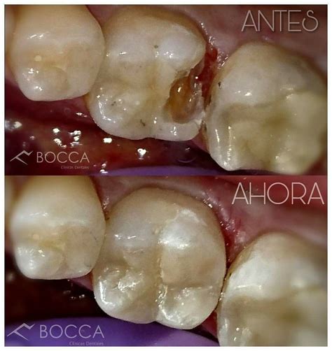 Pin en bocca clinicas dentales educación oral para todos