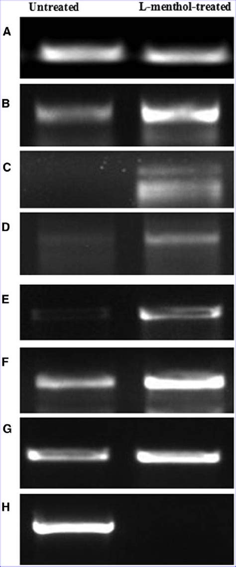 Representative Gel Image Depicting The Semiquantitative Rt Pcr Based
