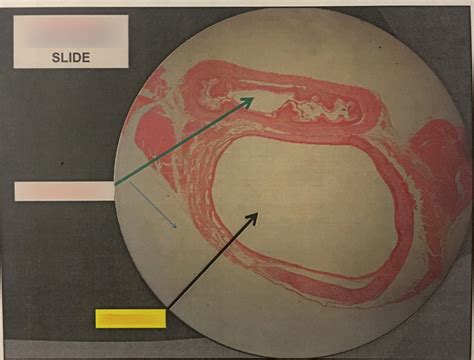 A P 2 Lab Practical 2 11 Diagram Quizlet