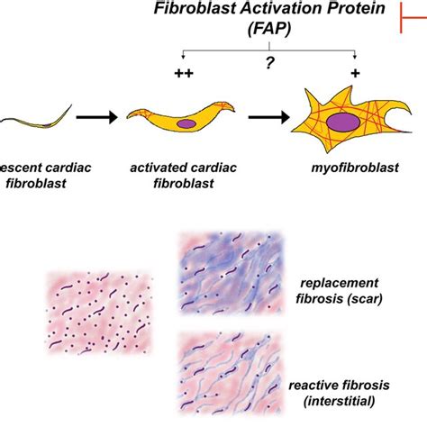 Clinical Imaging With ⁶⁸ga Fapi 46 After First Myocardial Infarction In