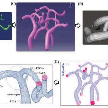 A CT Scan Image In DICOM Format B The MIMICS Software Output