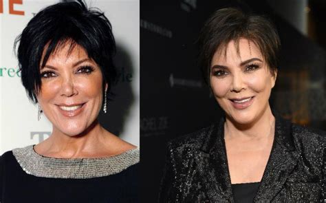 New And Improved The Top 15 Celebrity Plastic Surgeries For The Win