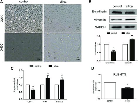 Silica 50 Mgml Induced Emt And The Downregulation Of Mir 29b In