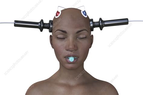 Electroconvulsive Therapy Illustration Stock Image F037 6750