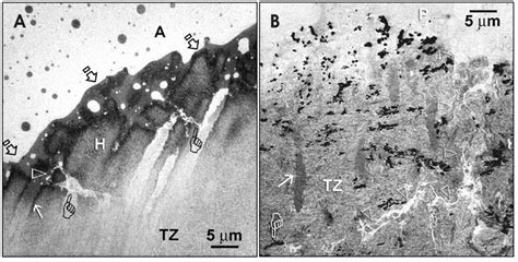 Tem Micrographs Illustrating The Application Of The Total Etch Adhesive