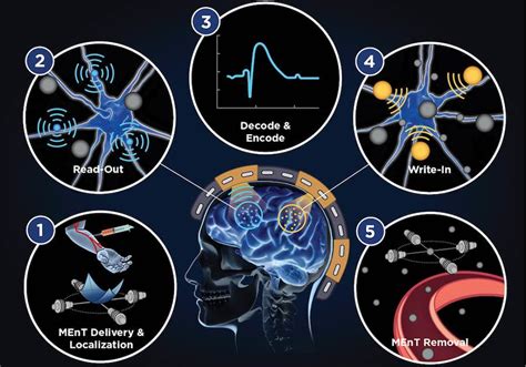 Battelle To Develop Injectable Bi Directional Brain Computer Interface Medical Design Briefs