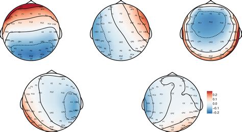 Figure 3 From A Hierarchical Random Effects State Space Model For Modeling Brain Activities From