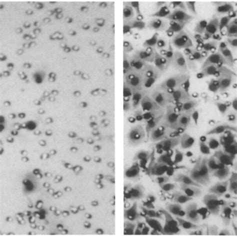 Recombinant Fn Mediated Migration Of Nii8 Hsv Cells Cell Migration