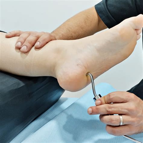 Qué es el Espolón calcáneo Por qué aparece y por qué duele