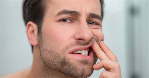 Gengive Bianche Da Cosa Sono Causate E Come Si Trattano