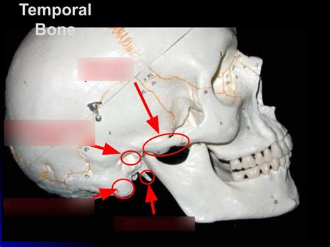 Parietal Temporal Occipital Diagram Quizlet