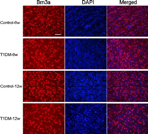 Brn3a Labeled Retinal Ganglion Cells In Flatmount Retinas Left Brn3a