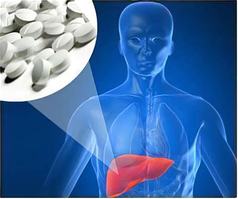 Damaged Liver From Medication