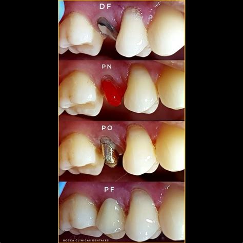 Rearrangement Artofit