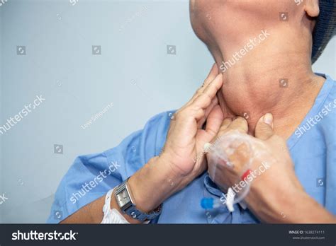 Enlarged Multinodular Thyroid Goiter Middleaged Asian Stock Photo