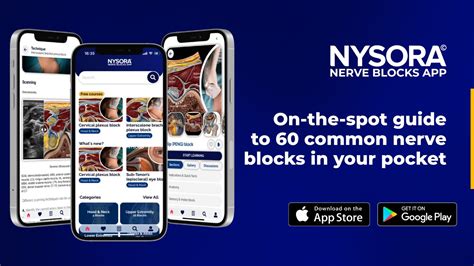 Just Added Intercostobrachial Nerve Block Technique Now Available In