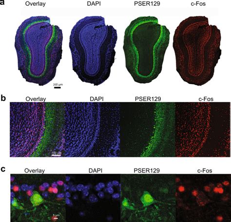 Distribution Of Phosphorylated Alpha Synuclein In Non Diseased Brain