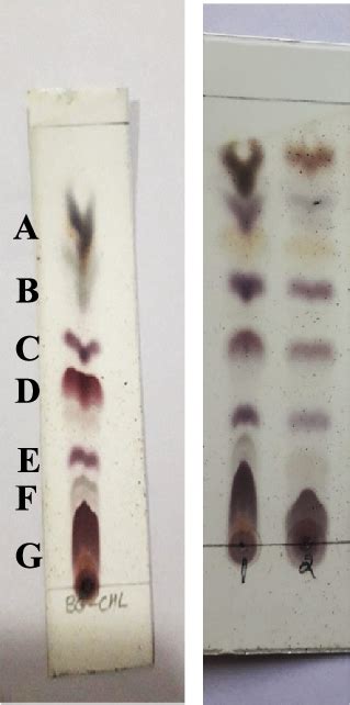 Tlc Charring Pattern Of Bg Chloroform Extract Tlc Code Bg Chl Unp