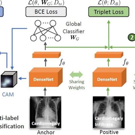 A Distance Learning Based Model For Thoracic Pathology Classification Download Scientific