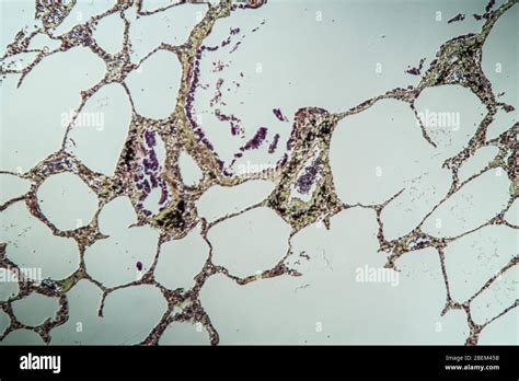 Simple Squamous Epithelium Lung Aveoli