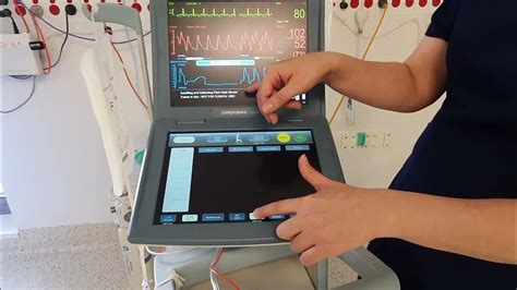 Iabp Fill On The Cardiosave Youtube