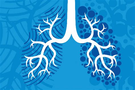 Breathe Easy With Our Complete Respiratory Panel Testing