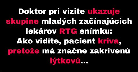 Doktor Ukazuje Začínajúcim Lekárom Rtg Snímku Vtip Čumil