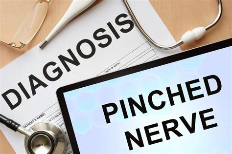 Can You Get A Pinched Nerve From A Car Accident Atlanta Car Accident