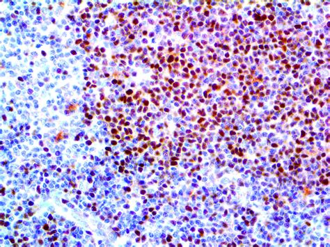 Cd79a Antibody Jcb117 Bio Sb