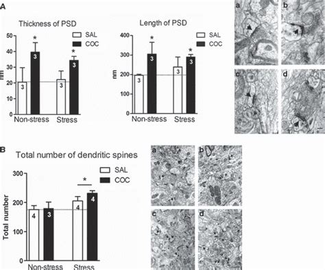 Em In The Pfc A The Length And Thickness Of Postsynaptic Density