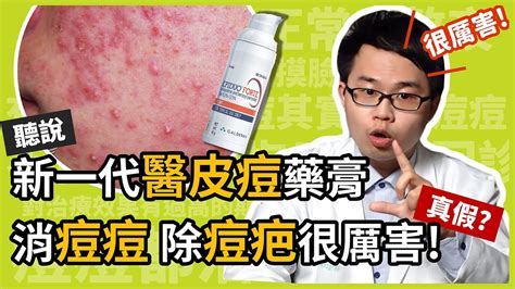 新一代醫皮痘 EPIDUO FORTE 藥膏可以消痘痘除痘疤真假皮膚科楊省三醫師幫你詳細分析醫皮痘複方凝膠為何痘痘肌患者滿意度高