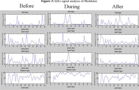 Figure 4 From Design And Implementation Of Eeg Signals Analysis On Fpga
