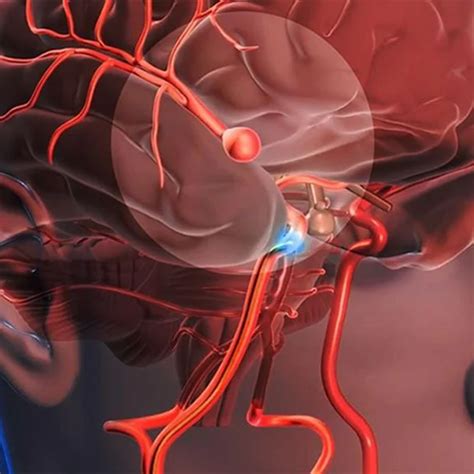 Neurosurgery Salamat Farda Hospital