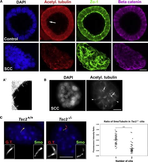 Supernumerary Centrosomes Nucleate Extra Cilia And Compromise Primary